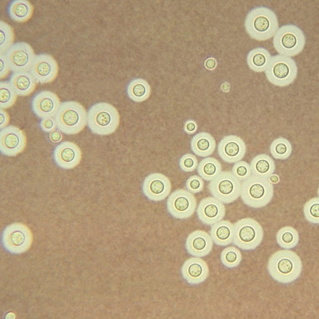 ReFRAME drug repurposing collection yields hope for treating diseases ...