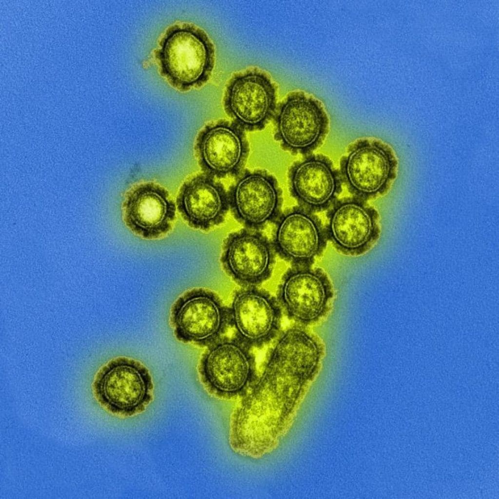 WHO announced influenza A(H1N2) variant virus infection in the Great ...